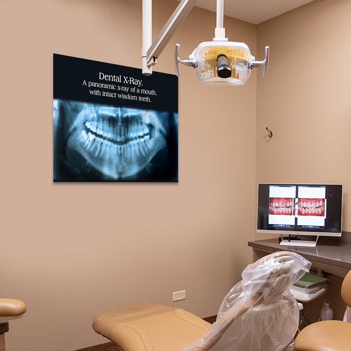 Dental x-ray. A panoramic x-ray of a mouth, with intact wisdom teeth ...