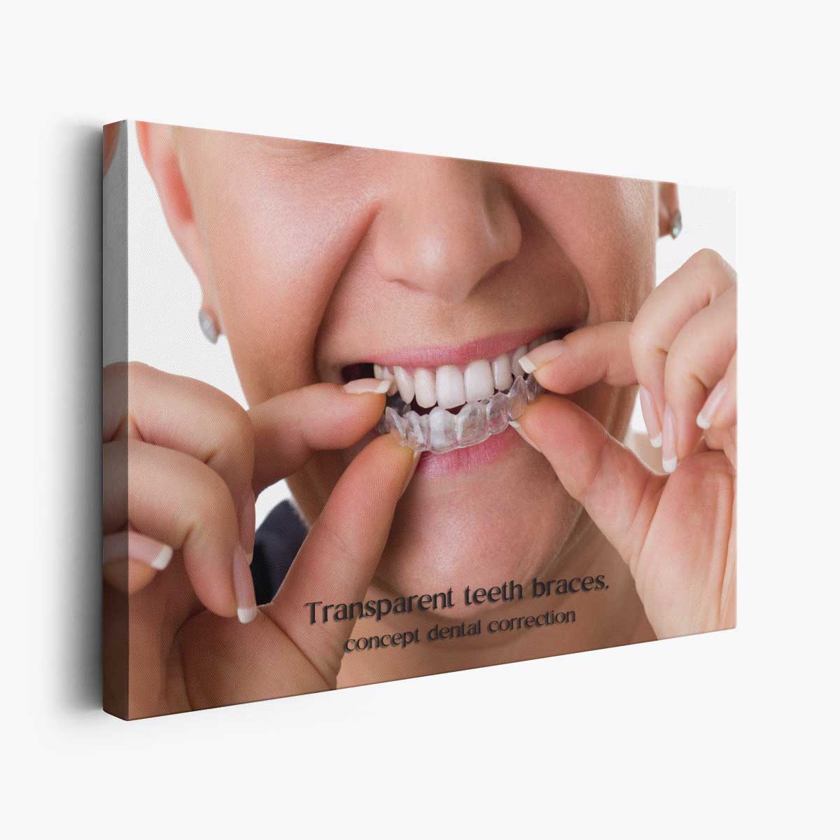 Transparent teeth braces, concept dental correction – Framer